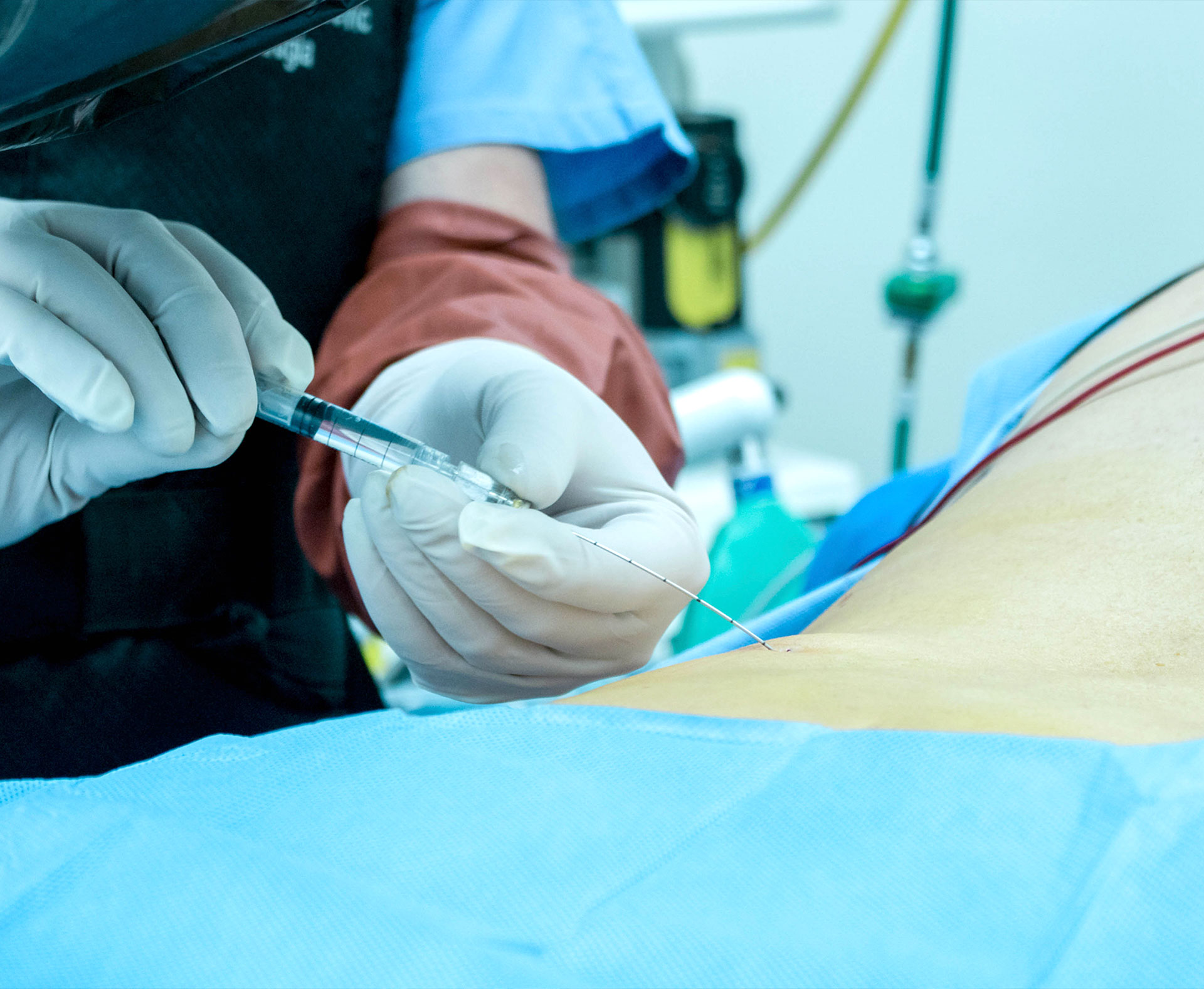 Bloqueo del Dolor – Dr. Radovan Sancevic